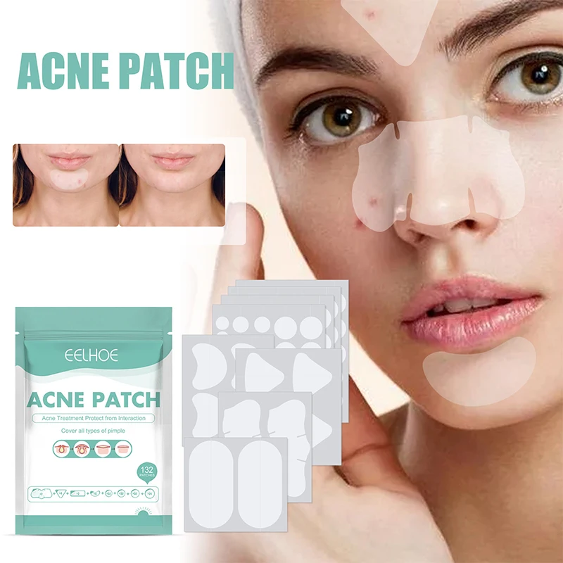 132Pcs-Acne-Pimple-Patches-Stickers-Acne-Spot-Treatment-Patch-Blemish ...