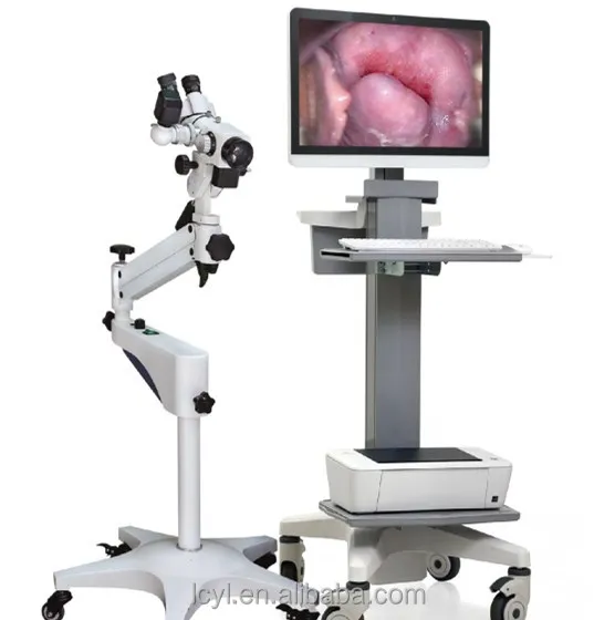 Equipamento do colposcópio ótico de hd para a ginecologia| | - AliExpress