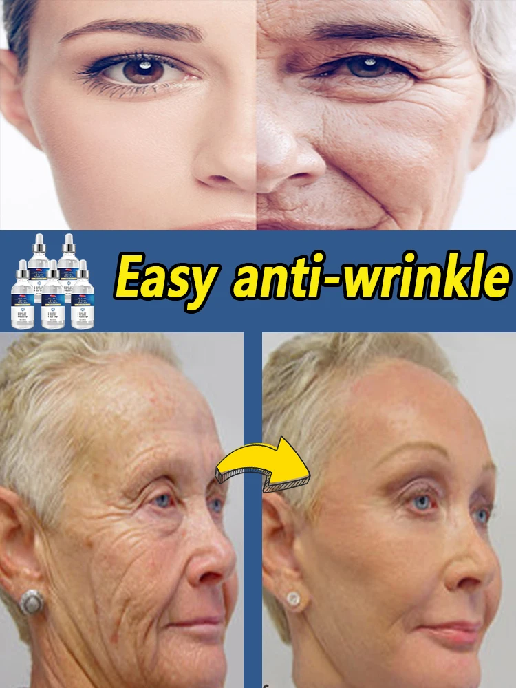 Smooths-out-wrinkles-20-years-younger-Become-beautiful-now.jpg