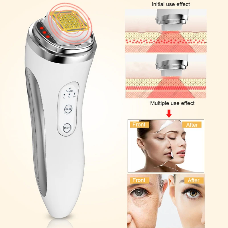 RF Radio Frequency Face Lifting Device Dot Matrix Beauty Massager Home ...