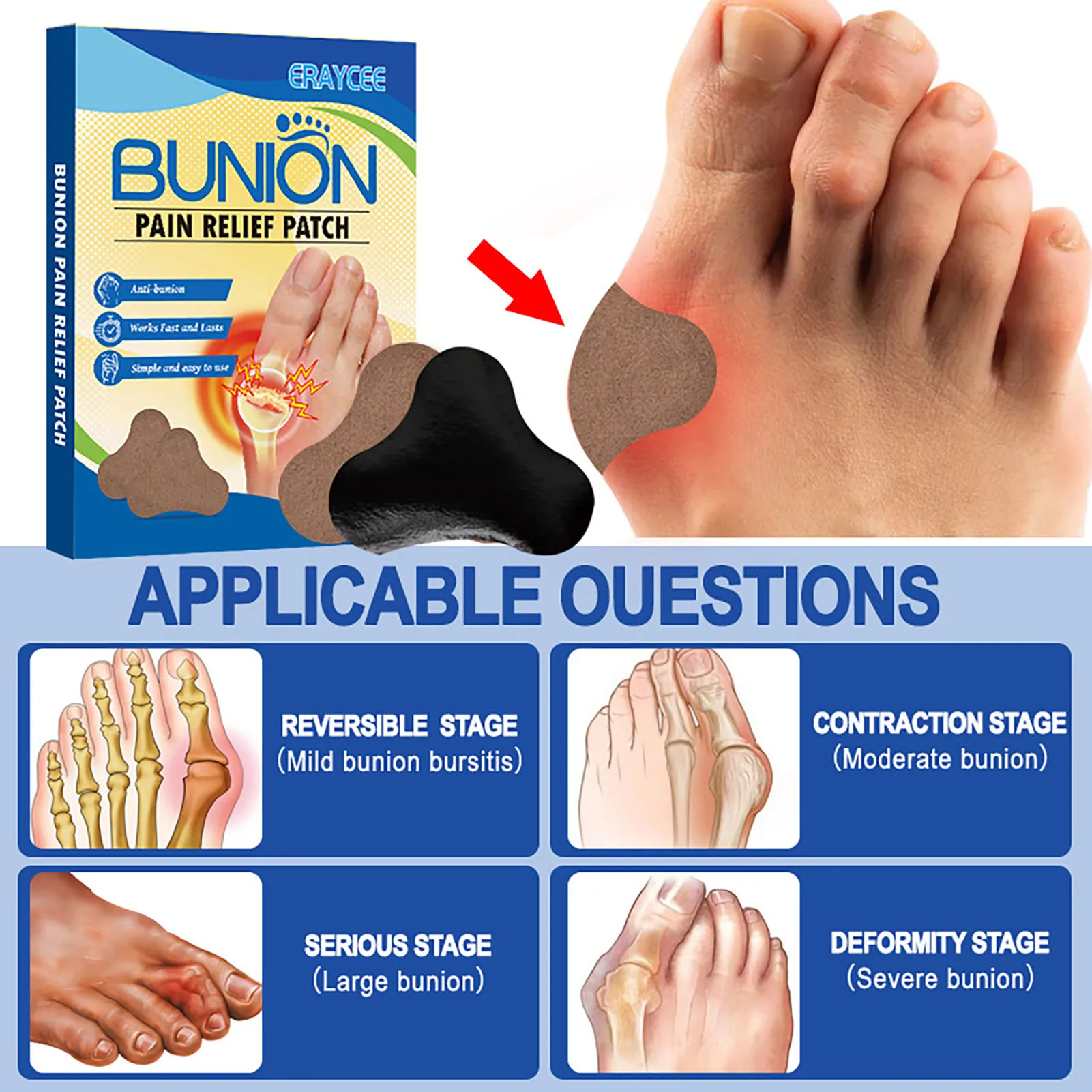 8pcs-Foot-Gout-Patch-Anti-bunion-Joints-Patches-Soothing-Arthritis-Bone ...