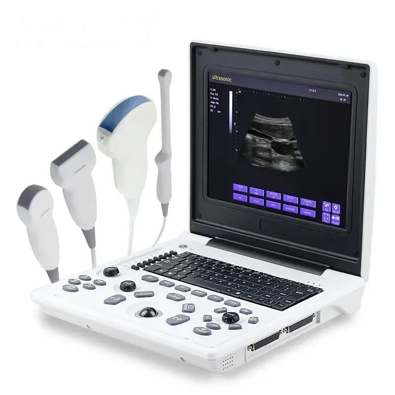 digital-echocardiography-instruments-sonography-ultrasonography-laptop ...