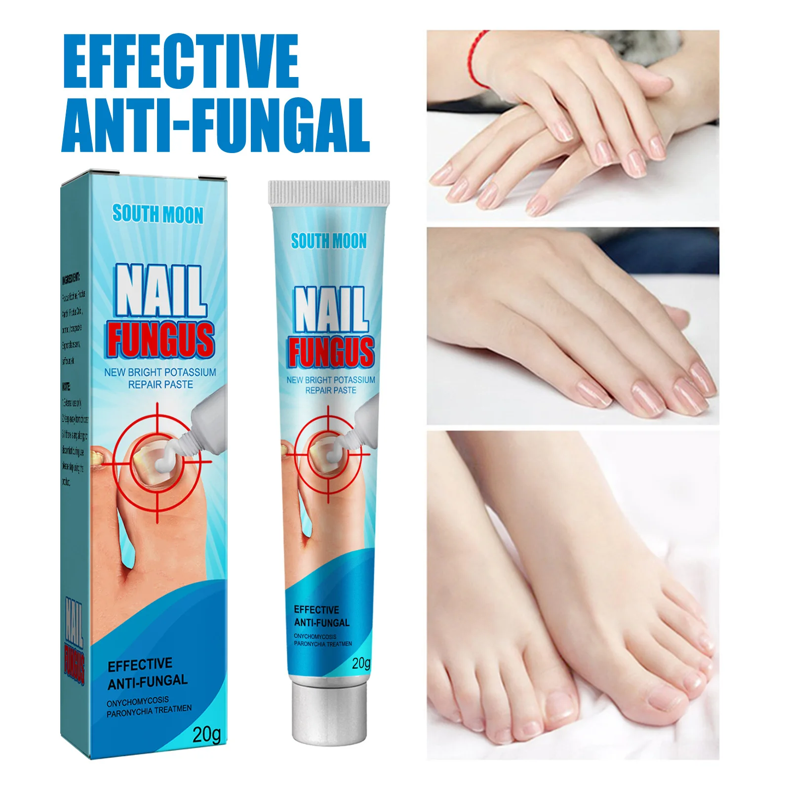Nail-Fungus-Removal-Ointment-Onychomycosis-Paronychia-Treatment ...
