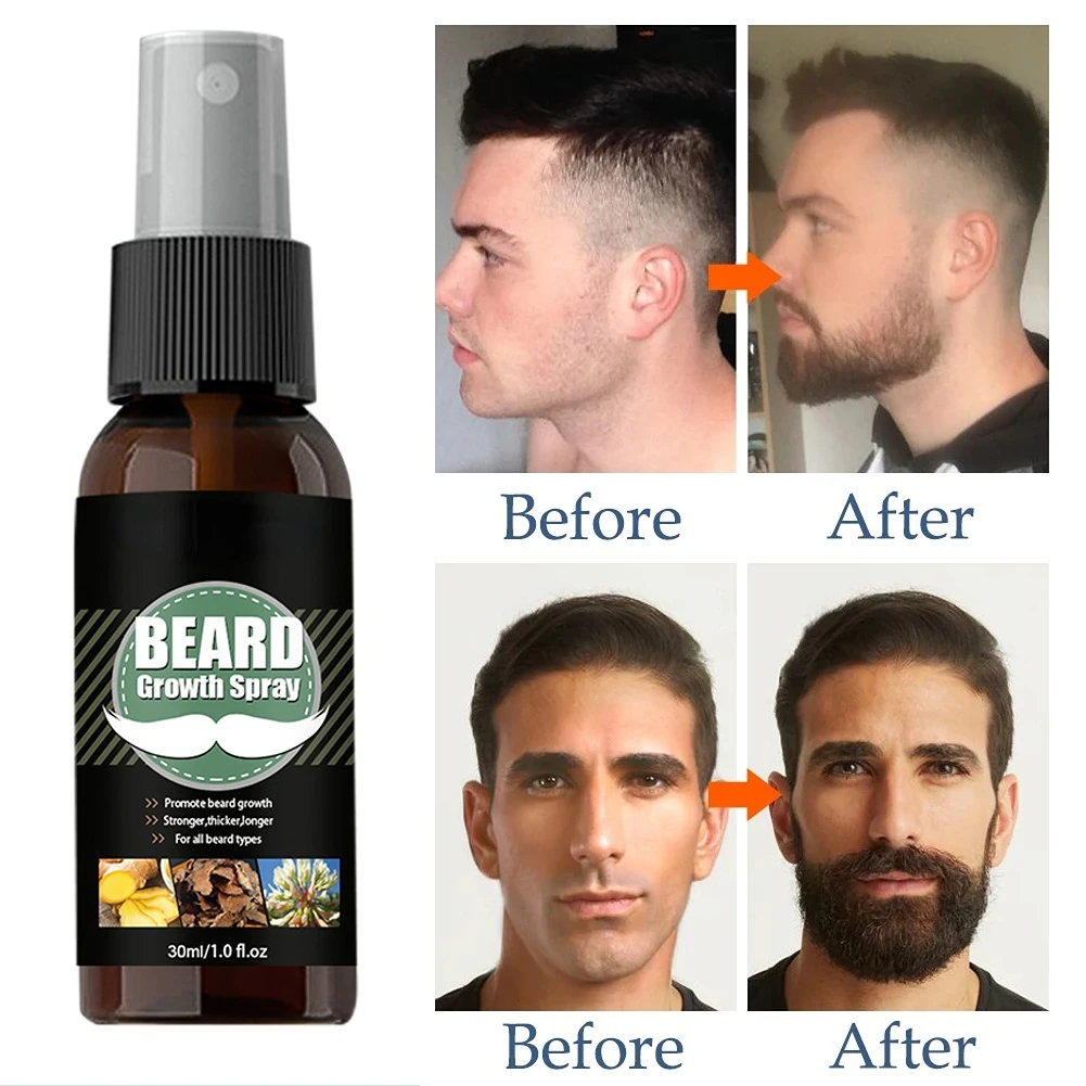 Beard Growth Oil Spray Fast Hair Growth Essential Oils Essence Serum ...
