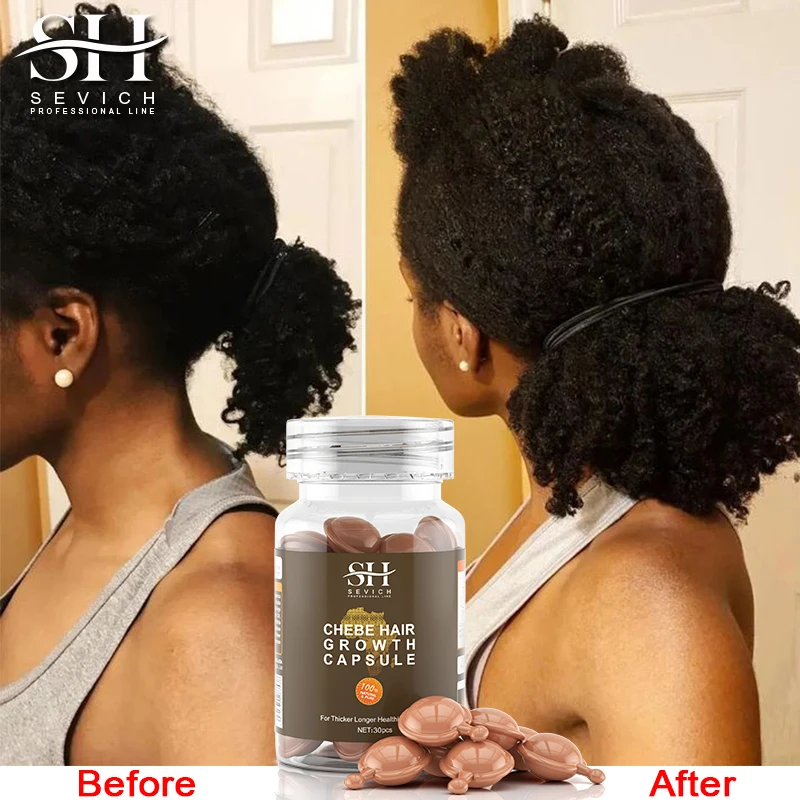 Chebe-Fast-Hair-Growth-Capsule-Chad-100-Natural-Hair-Growth-Oil-Anti ...