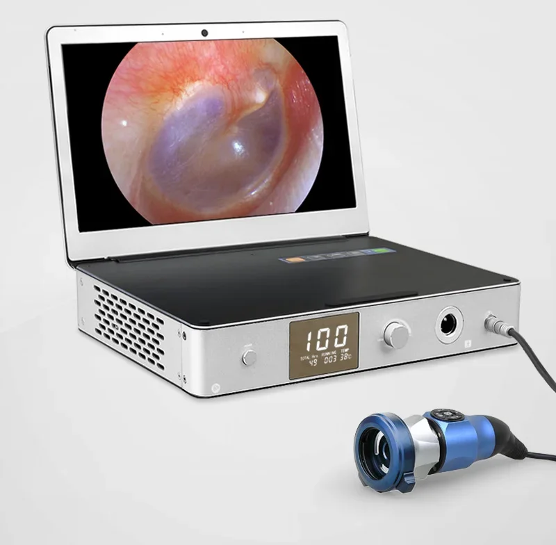 3-In-1-Medical-Full-HD-1080P-Endoscopy-Endoscope-Camera-with-LED-Light ...
