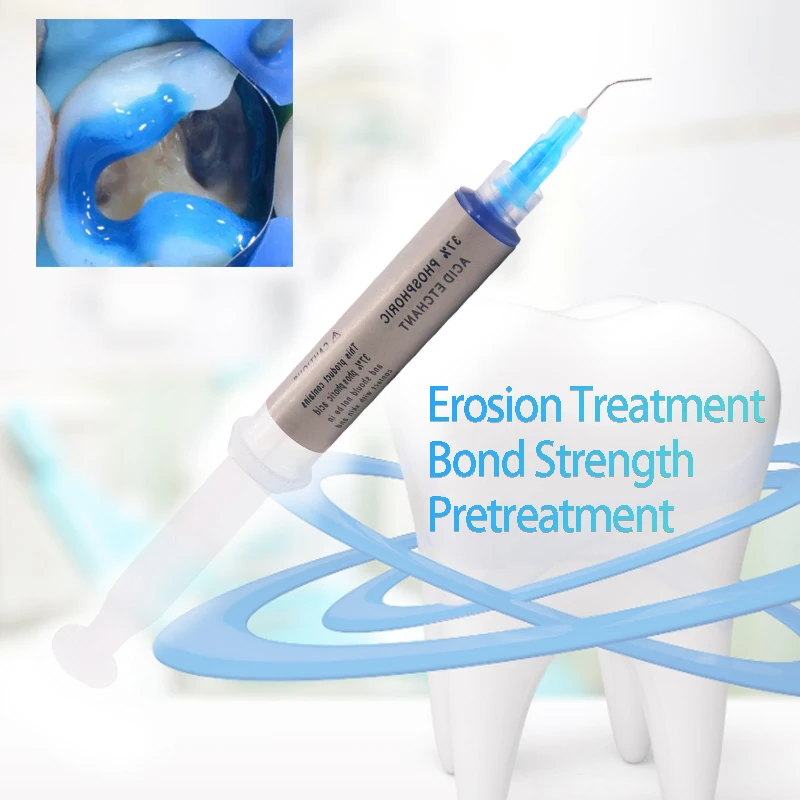 Dental Acid Etching Gel Etching Light-Cure Crystal Ornament Jewelry ...