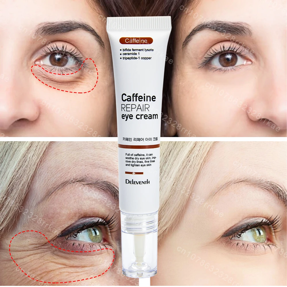 Eye-cream-removes-eye-bags-puffiness-dark-circles-eye-wrinkles-Fade-Eye ...
