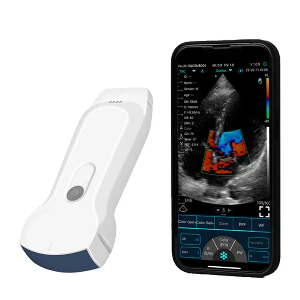 Wireless-Ultrasound-Scanner-Dual-Head-Convex-Linear-Cardiac-Preset-3-in ...