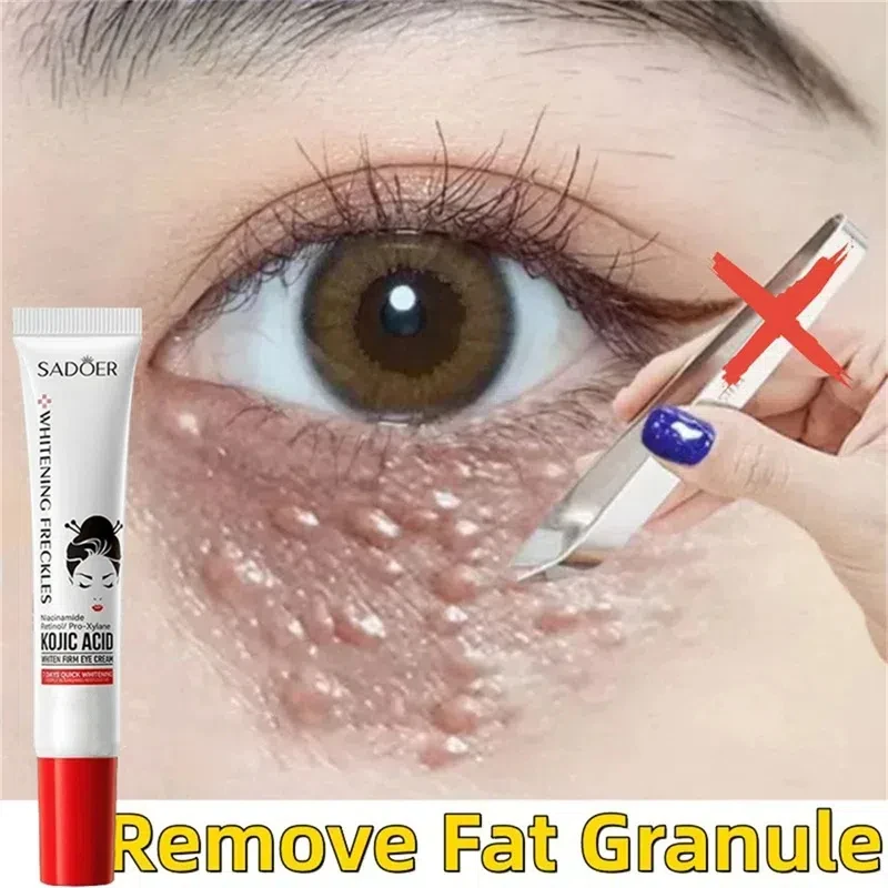 Crema-para-ojos-eliminador-de-gr-nulos-de-grasa-crema-firme-antihinchaz-n-antiinflamatorio ...