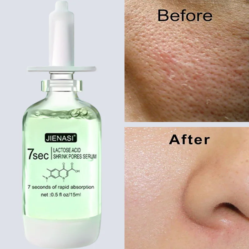 Pore-Shrinking-Serum-Face-Removing-Large-Pores-Tightening-Repairing ...