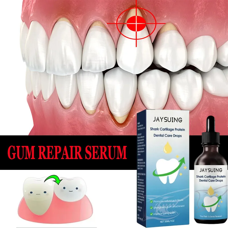 Gum Drops for Oral Health: The Ultimate Guide to Relief, Care, and ...