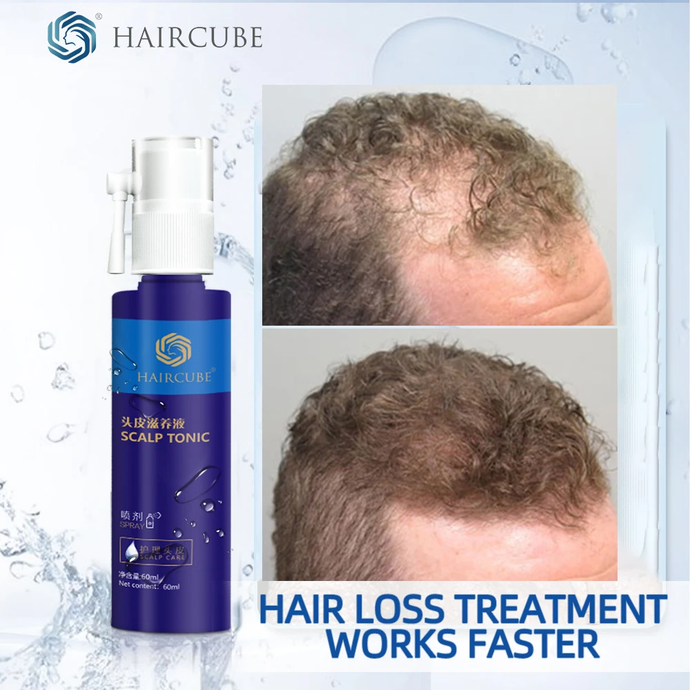 Anti-Hair-Loss-Fast-Hair-Growth-Spray-Prevent-Hair-Loss-Nourish-Essence ...