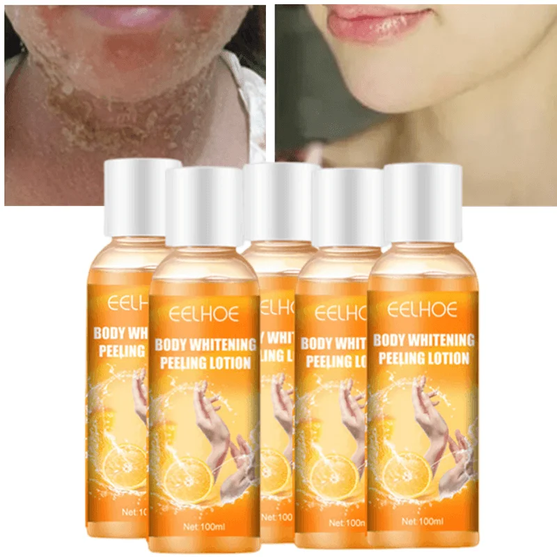 Immediate Dark Skin Removal Whitening Peeling Gel Brighten Finger Knee ...