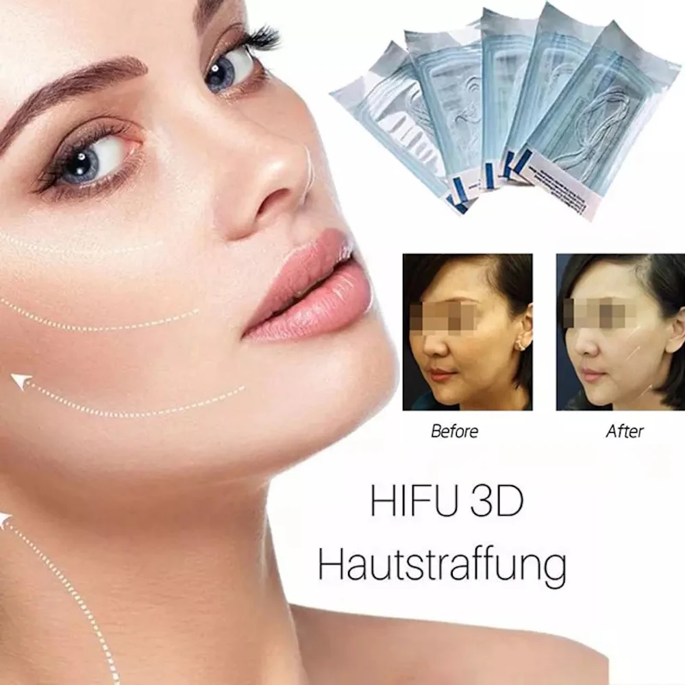 Radar-Thread-No-Needle-Silk-Fibroin-Line-Carved-Protein-Line-Collagen ...