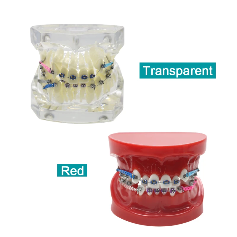 Orthodontic-Teeth-Model-Dental-Typodont-Orthodontic-Teeth-Model-1-1 ...
