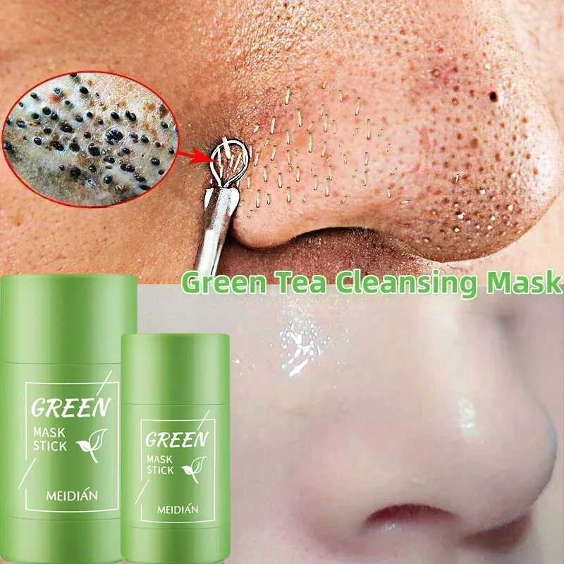 Original-Facial-Remove-Blackhead-Green-Tea-Solid-Mask-Treat-Acne ...
