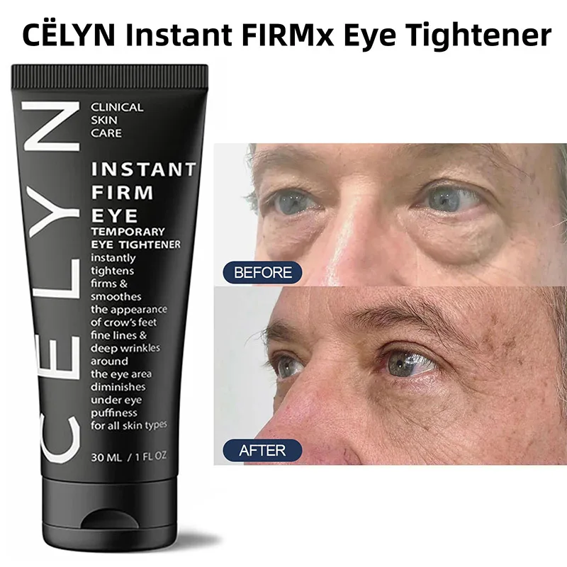 C-lyn-Make-Up-Eye-Firmer-Eye-Lift-Firm-Eye-Bag-Removal-Wrinkle-Removal ...