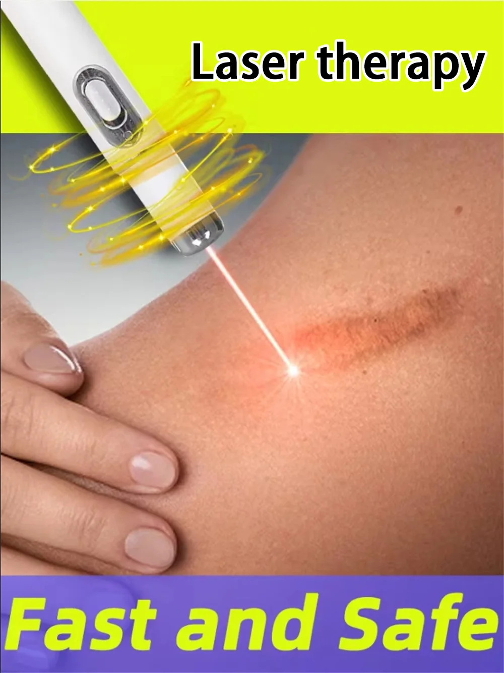 Laser-therapy-Keloid-scar.jpg