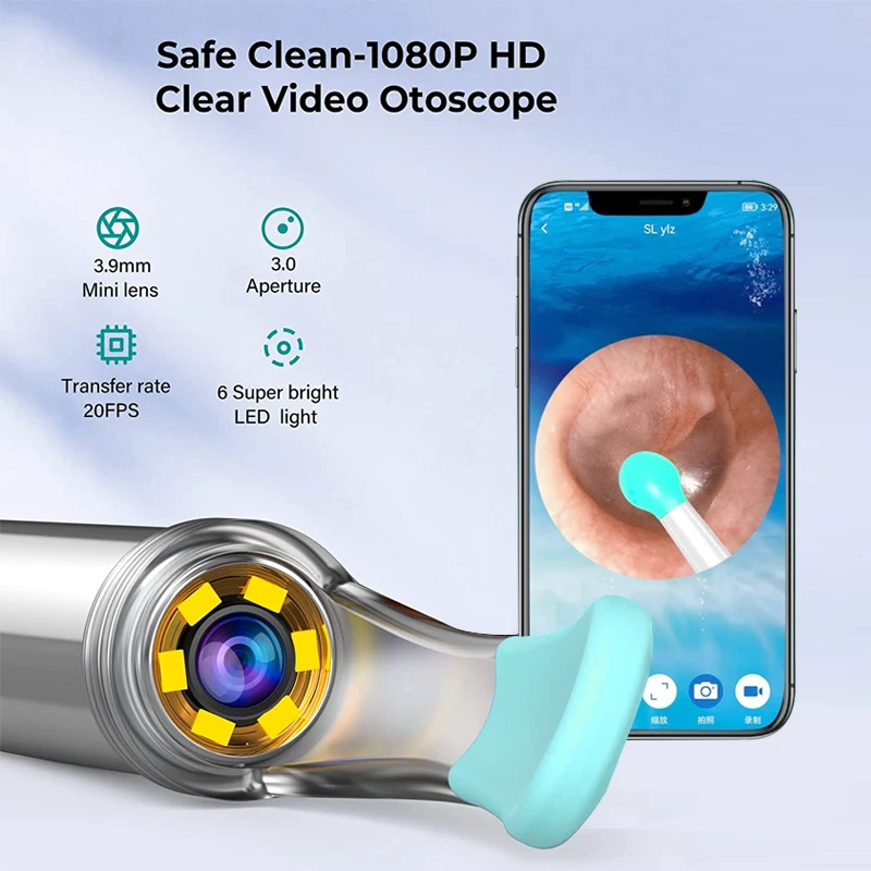 Otoscope