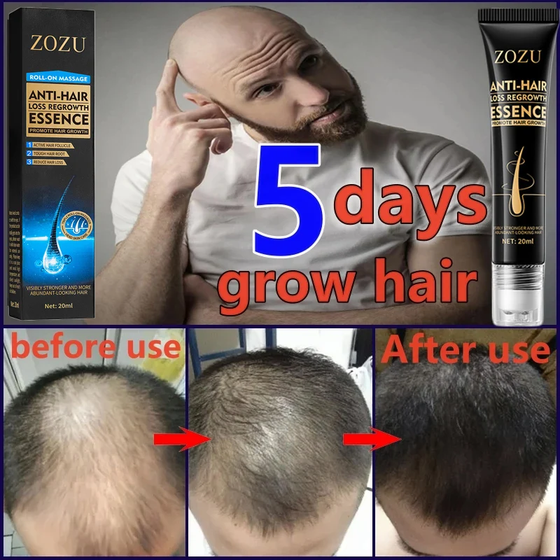 Fast-Hair-Growth-Essence-Effective-Anti-Hair-Loss-Prevent-Hair-Dry ...