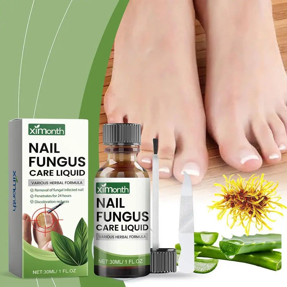 Onychomycosis-Hand-Foot-Removal-Repair-Care-Nail-Fungal-Treatment-Serum ...