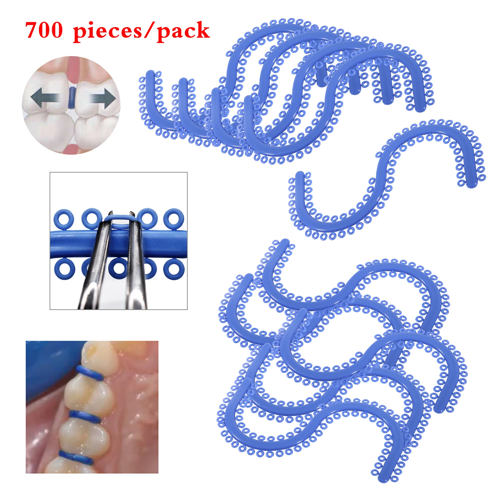 1-bag-Dental-Separate-Teeth-Dental-Tool-Orthodontic-Separator-Tie-Blue ...
