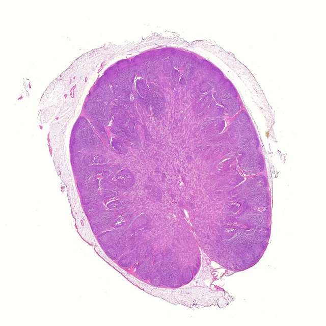 Lamellar Corpuscle Slide