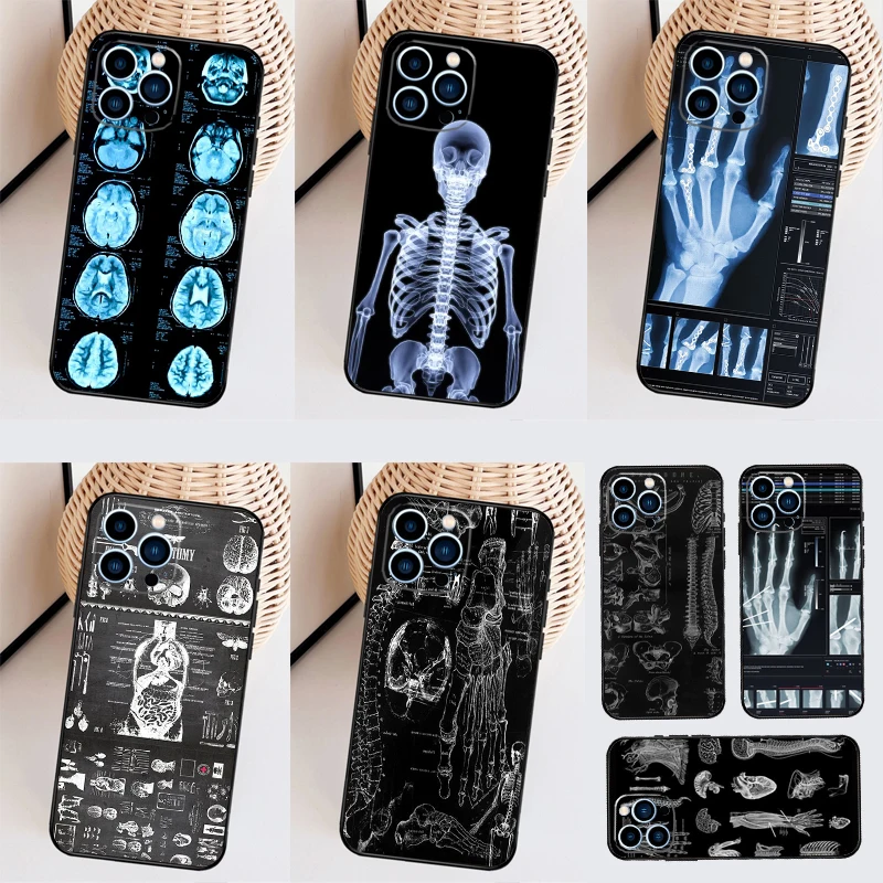 Radiological Human Organs Skeleton Cover Case For iPhone 14 Pro 11 16 ...