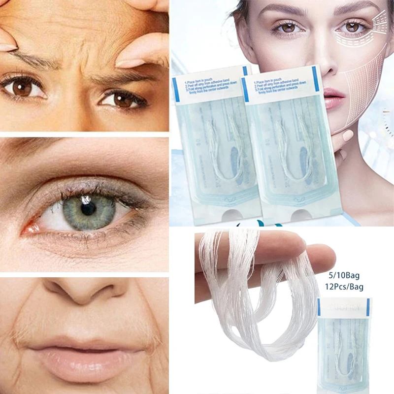 60-120Pcs-Protein-Thread-No-Needle-Protein-Line-Absorbable-Collagen ...