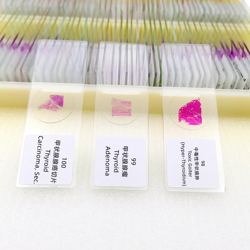 100Pcs-Medical-Human-Pathology-Set-Pathological-Prepared-Slides.jpg