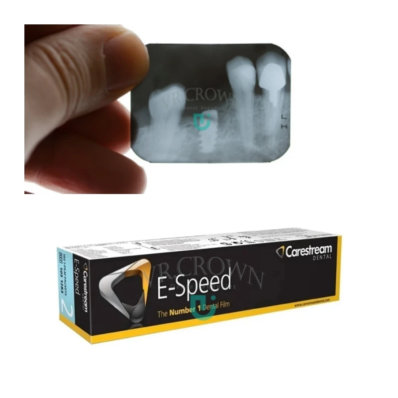 CareStream-D-Speed-E-Speed-Intraoral-X-Ray-Films-Kodak-Dental-Use-D-E ...