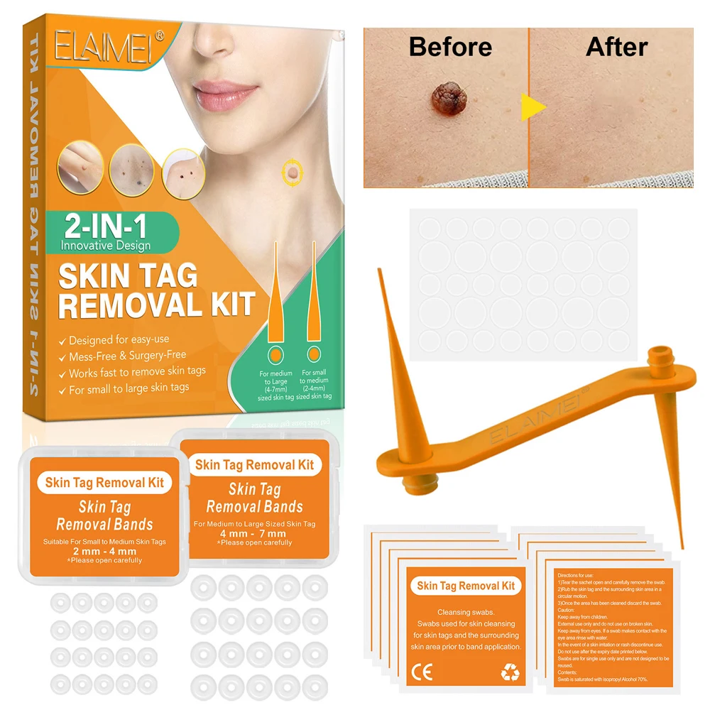 2-In-1-Skin-Tag-Removal-Tool-Skin-Tag-Removal-Kit-Home-Use-Mole-Wart ...