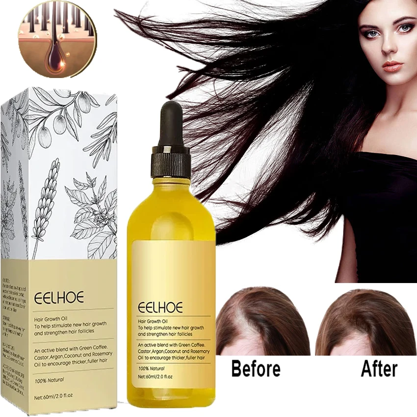 Anti-Hair-Loss-Natural-Hair-Growth-Oil-Nourishing-Essential-Oil-For ...