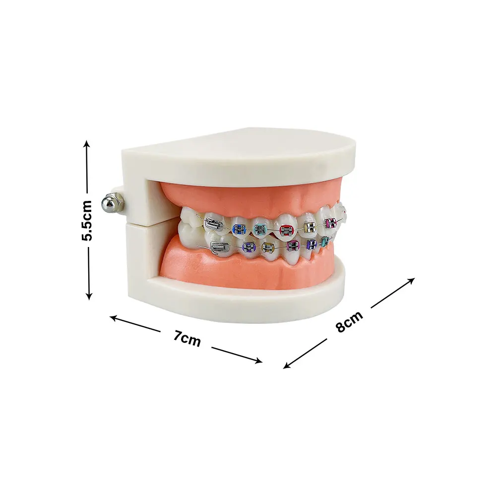 Metal Bracket Braces