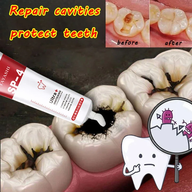 Toothpaste-of-Teeth-Whitening-Repair-of-Cavities-Caries-Removal-of ...