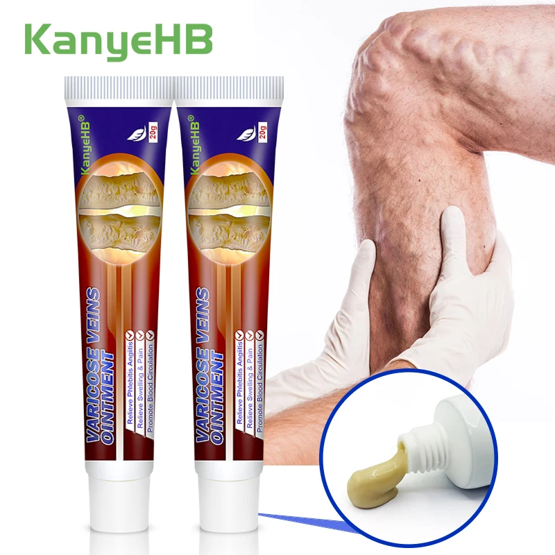 2pcs-Varicose-Veins-Treatment-Cream-Swollen-Blood-Vessels-Varicocele ...