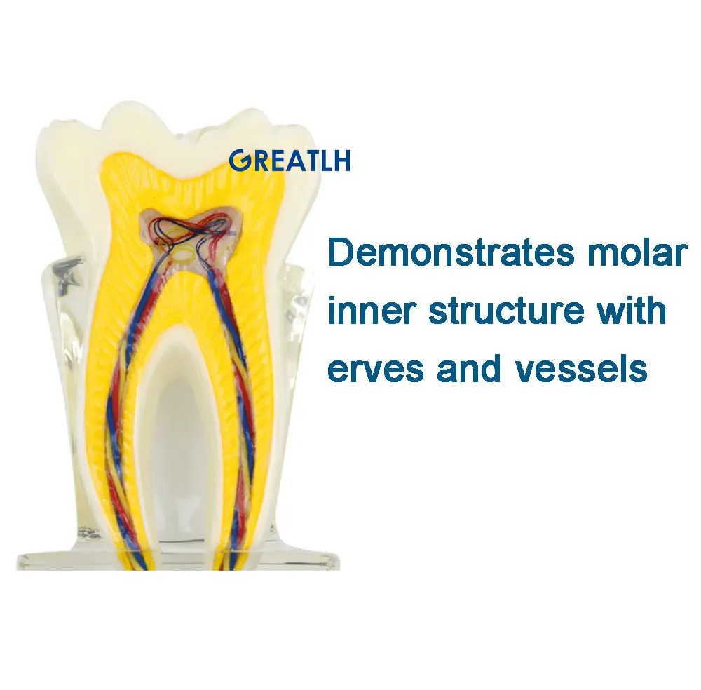 Orthodontic Model 6:1 Teeth Teaching With Clear Base Nerve Anatomical ...