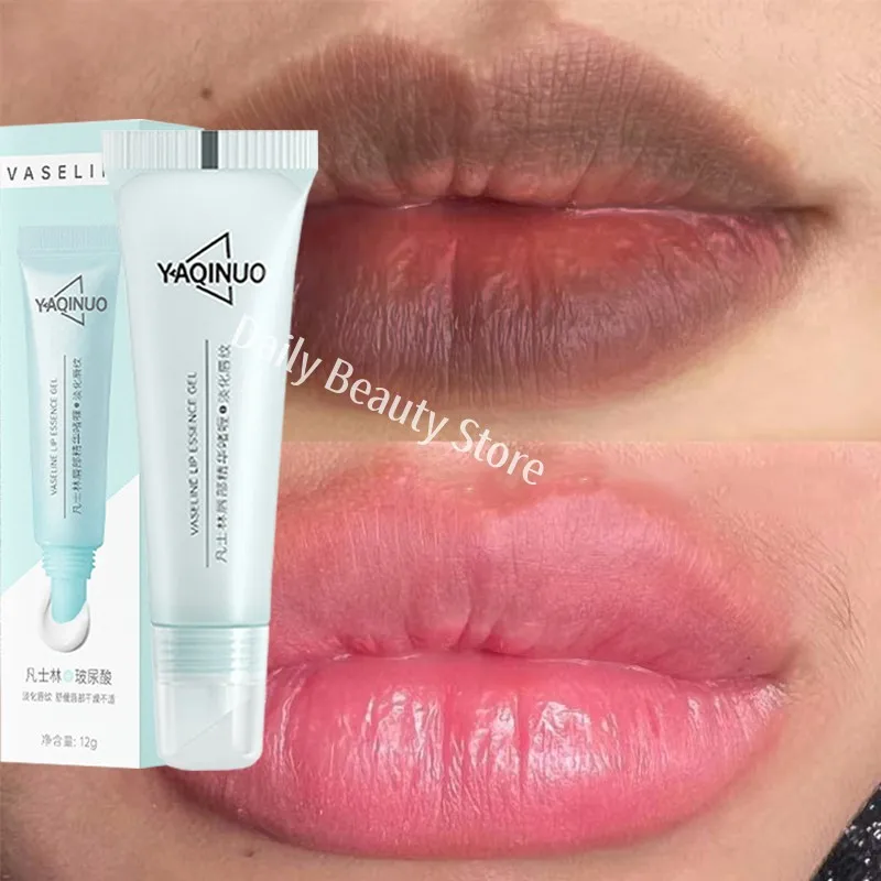 Remove Dark Lip Balm Fast Lightening Pink Lip Exfoliating Fade Lip Line ...