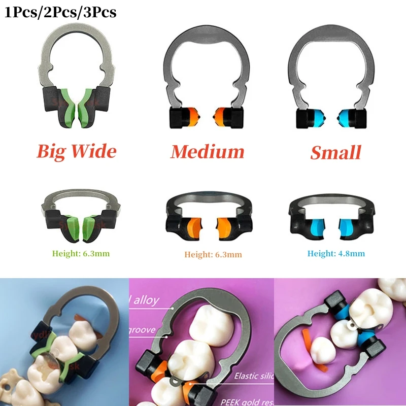 New-Dental-Matrix-Bands-NITI-Spring-Clamping-Ring-Sectional-Contoured ...