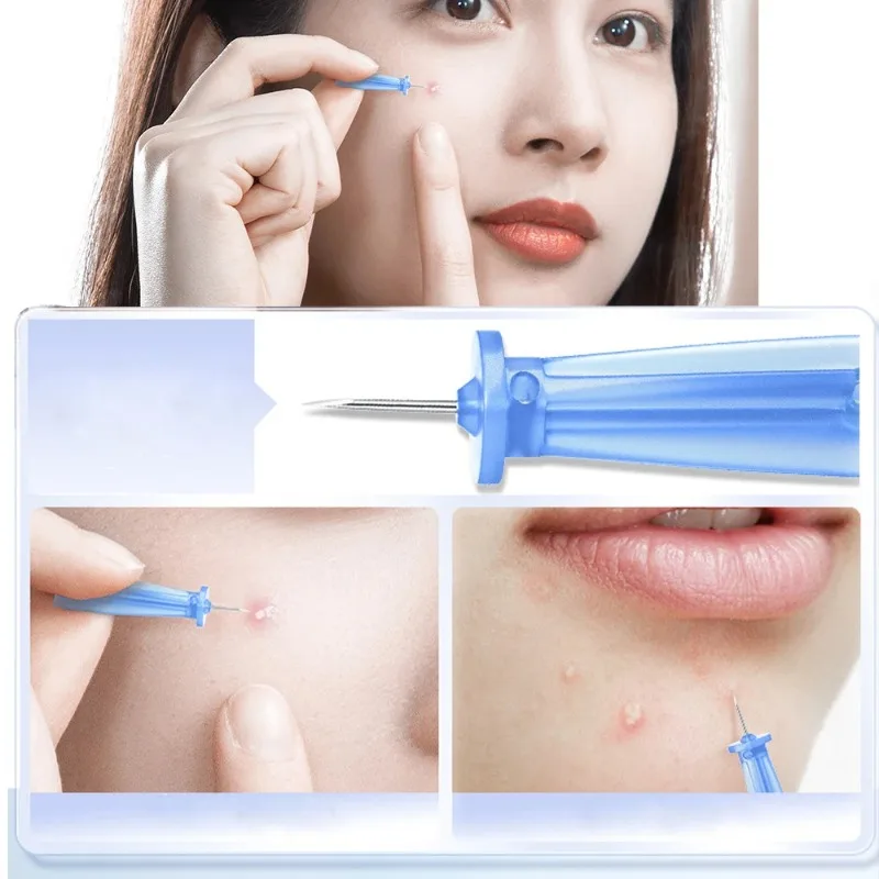 Disposable-Acne-Needles-Blackhead-Remover-Acne-Needle-Tool-Fat-Grain ...