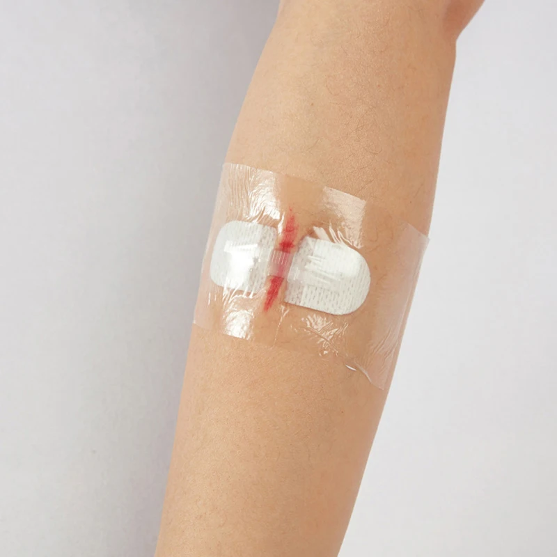 Stitch Free Adhesive Tape For Medical Wound Closure Strips Surgical ...