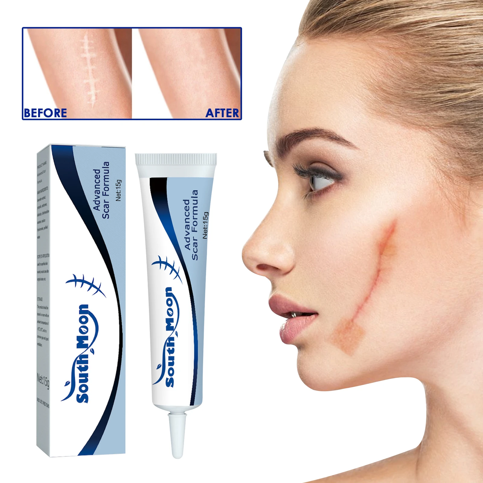 Scar Spots Repair Gel Body Stretch Marks Correct Burn Pigmentation Smoothing Cesarean Surgical ...