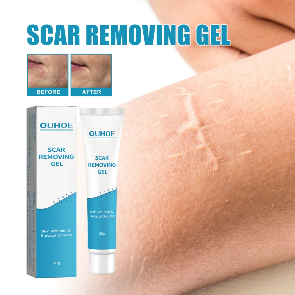 Scar-cream-gel-effective-repair-surgical-scars-stretch-marks-acne-pits ...