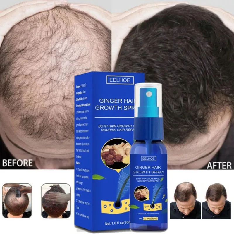 IngwerKraft matu augšanas seruma sprejs: pret matu izkrišanu un veicina ...