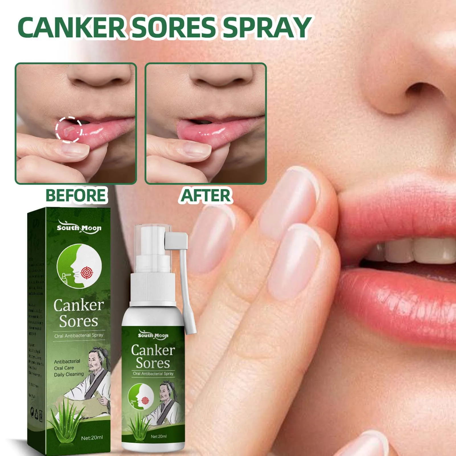 Espray bucal Herbal para limpieza de la boca, tratamiento bucal ...