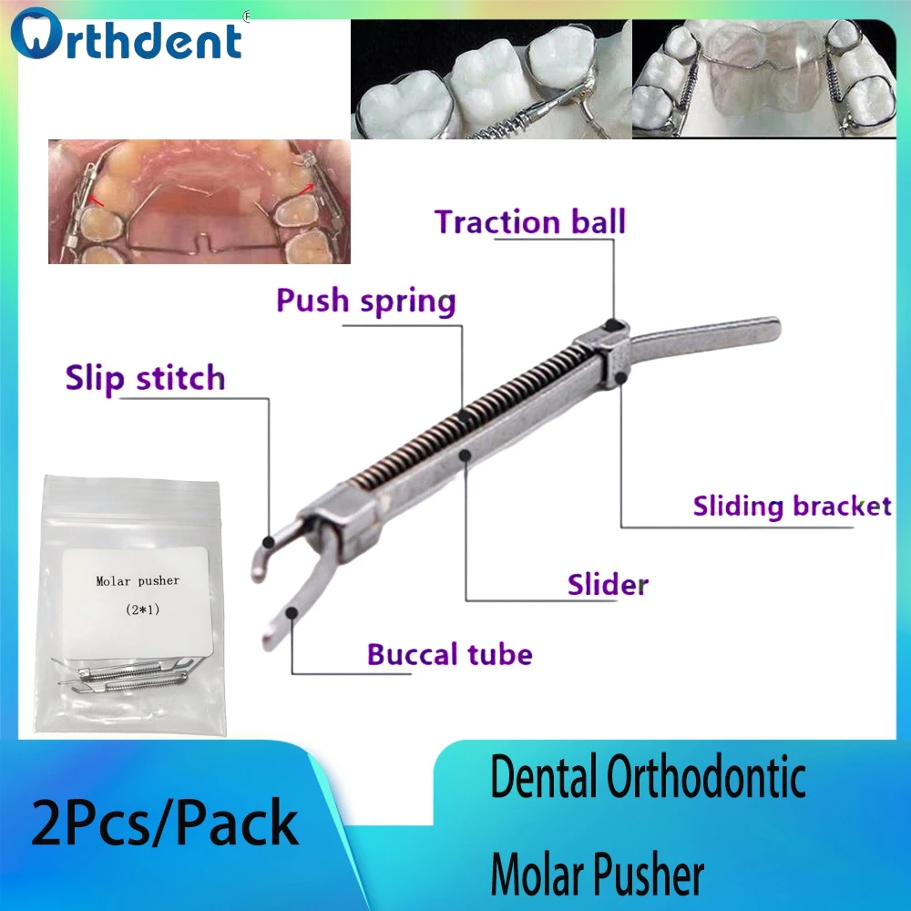 2Pcs/Pack Dental Orthodontic Molar Pusher Arch Expander Bracket Buccal ...
