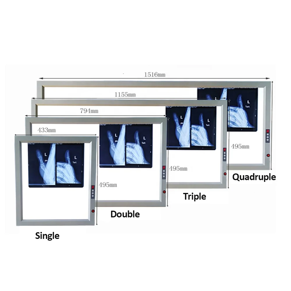 Adjustable Medical LED X Ray Imaging Film Viewer View Box Xray Viewer ...