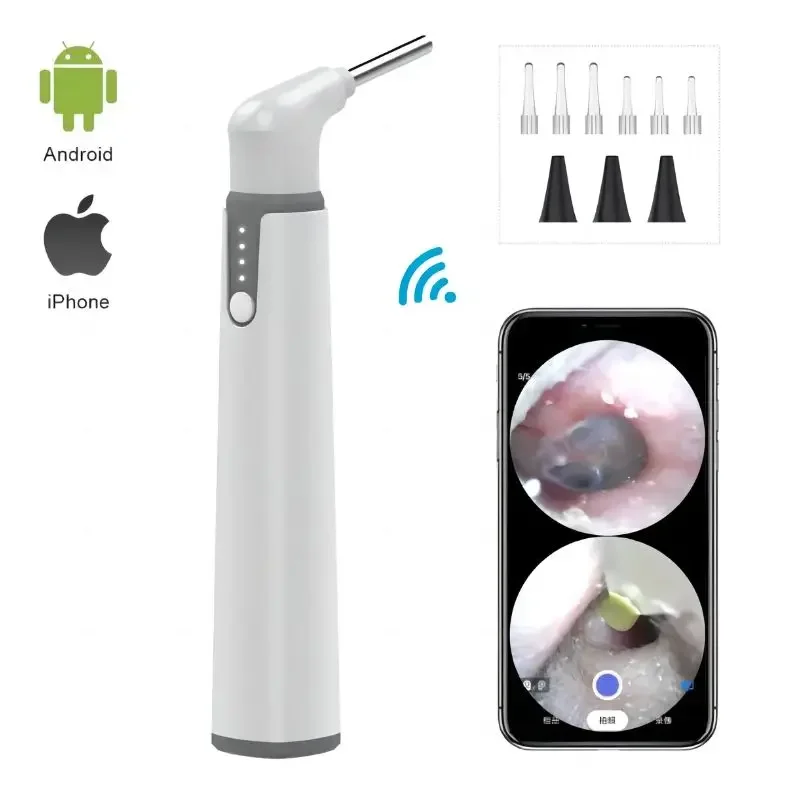 Ear-Scope-Camera-with-Dual-View-Wifi-Digital-Otoscope-3-9mm-720P-with-6 ...