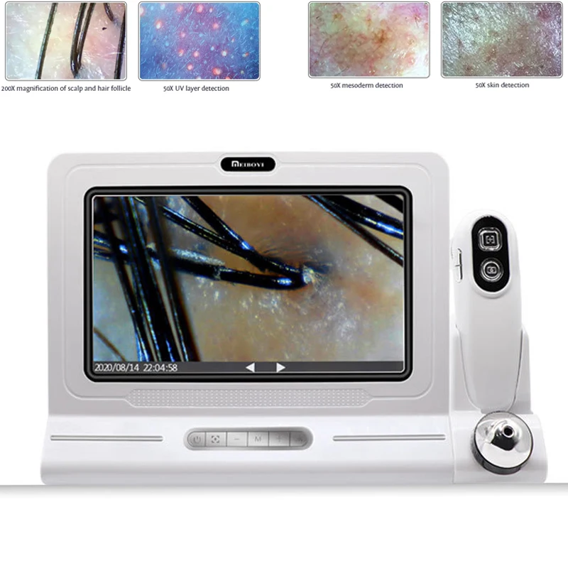 NEW-11-Inch-Scalp-Skin-Hair-Analyzer-Detector-Digital-UV-Testing ...